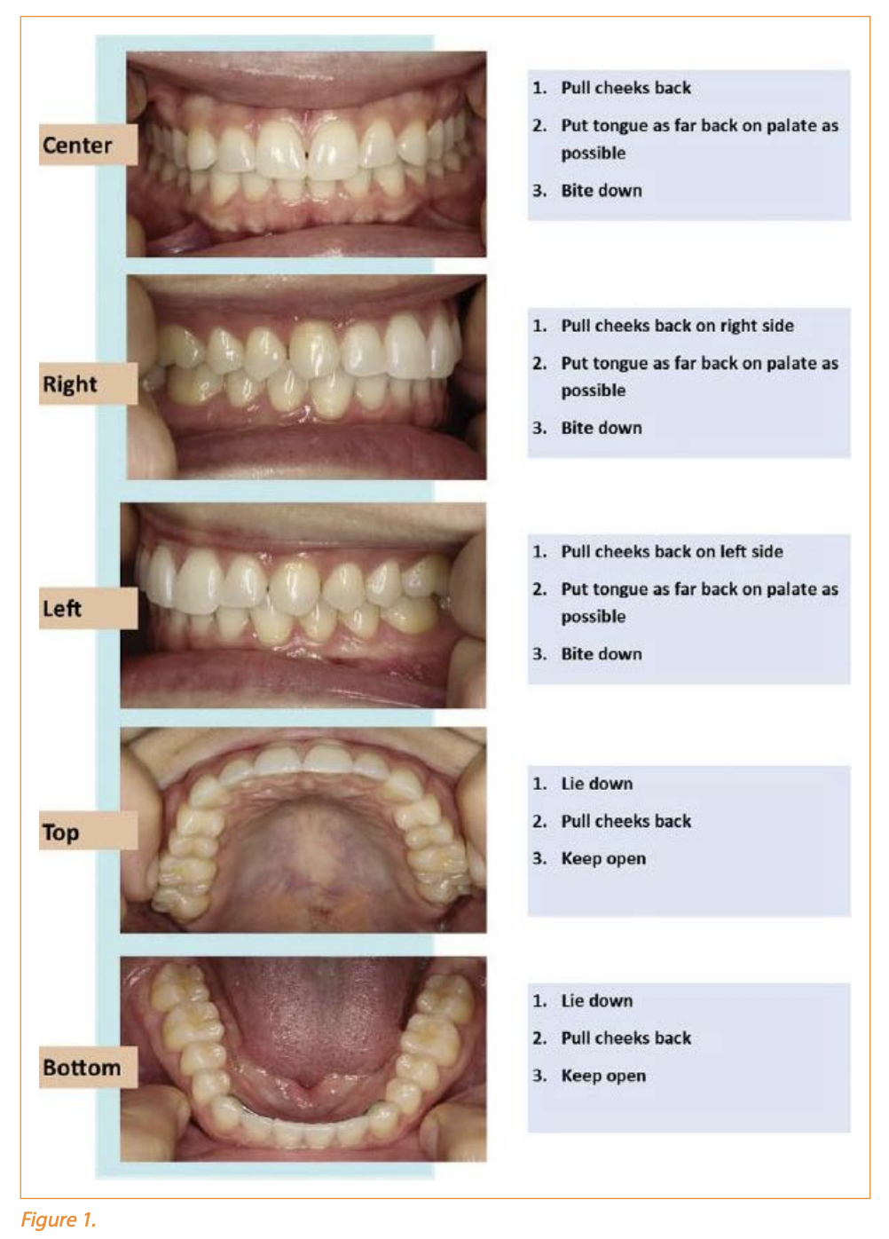 Virtual Exam Consultation In Orthodontics PCSO Summer 2022 Bulletin